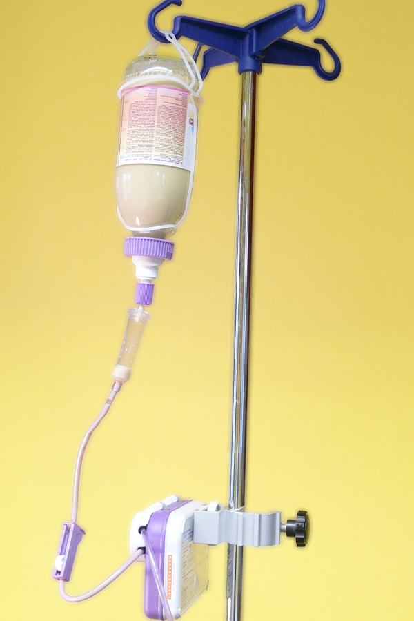 Enterale Ernährung - Sanitätshaus RECARA